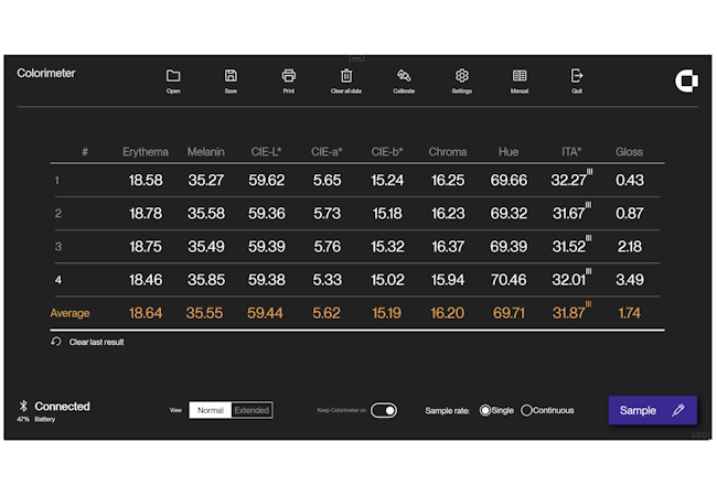 Colorimeter DSM 4 - Gieffe Medical